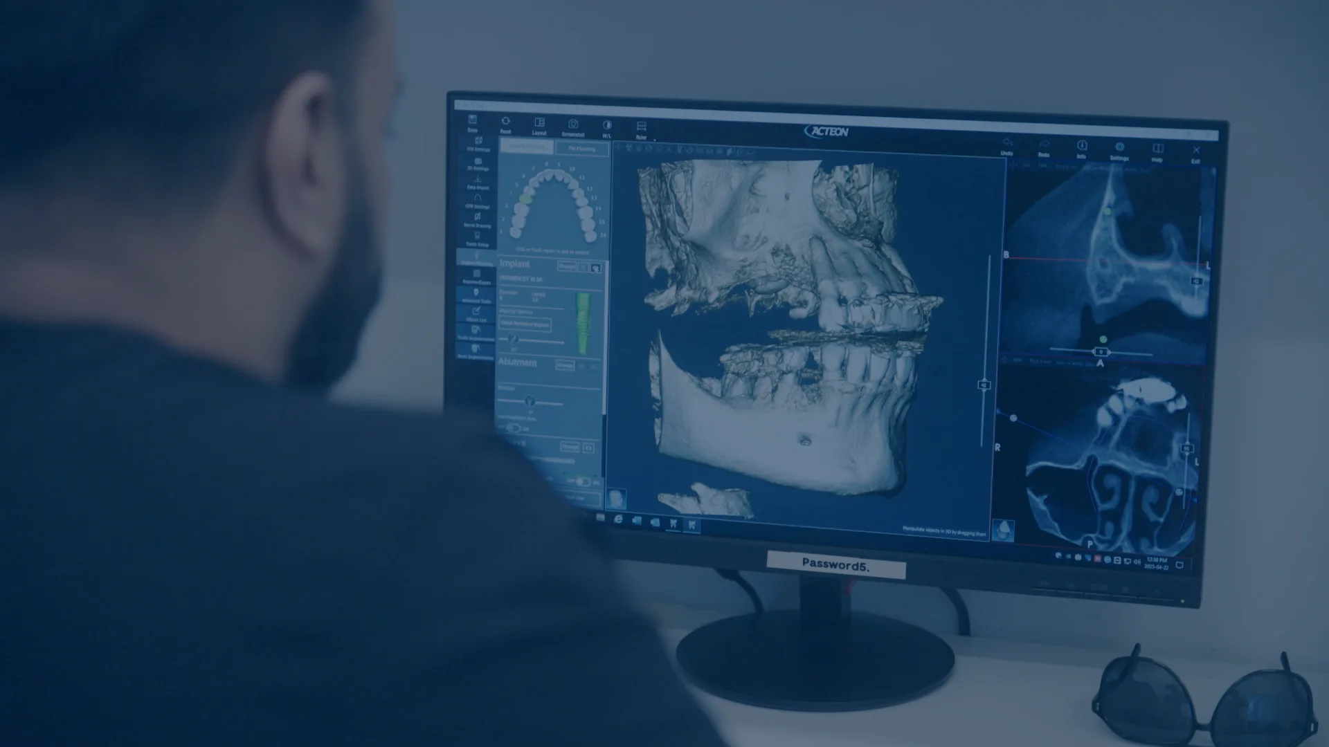 Treatment Planning Guidance – Clinical Catalyst